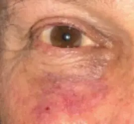 Our Work - Dr. William Rob Vickers, Oculoplastic Surgeon — Gulfstream Eye