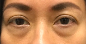 Our Work - Dr. William Rob Vickers, Oculoplastic Surgeon — Gulfstream Eye